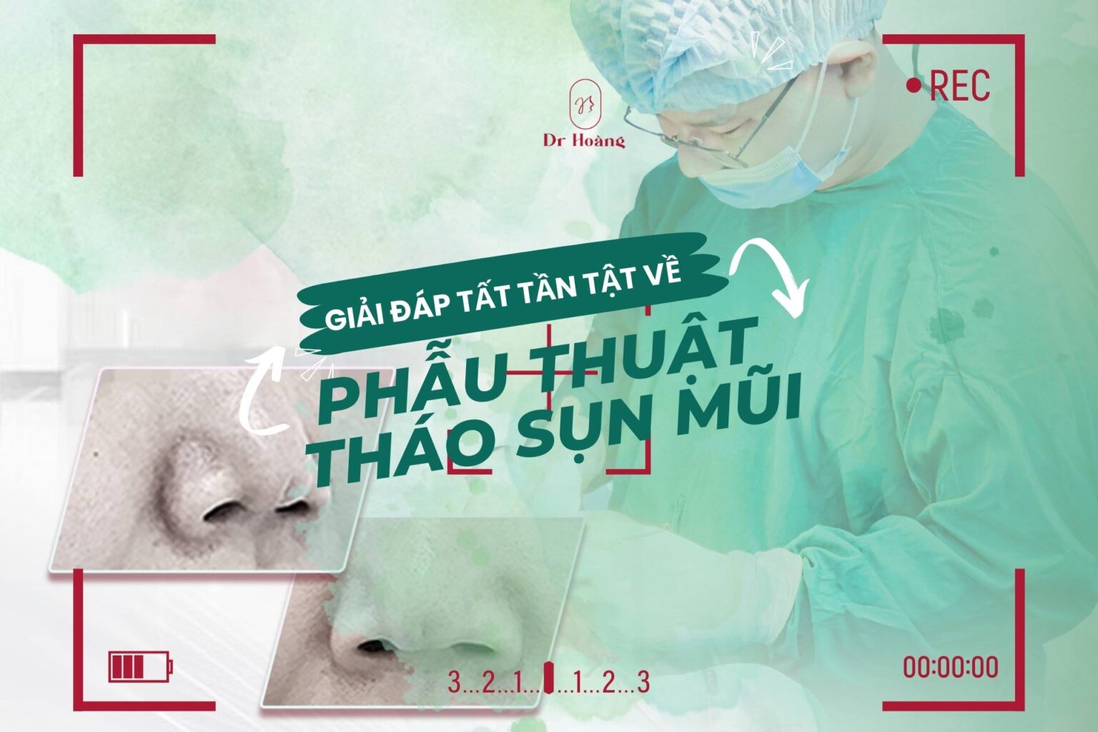 Dr.Hoàng giải đáp tất tần tật về phẫu thuật tháo sụn mũi